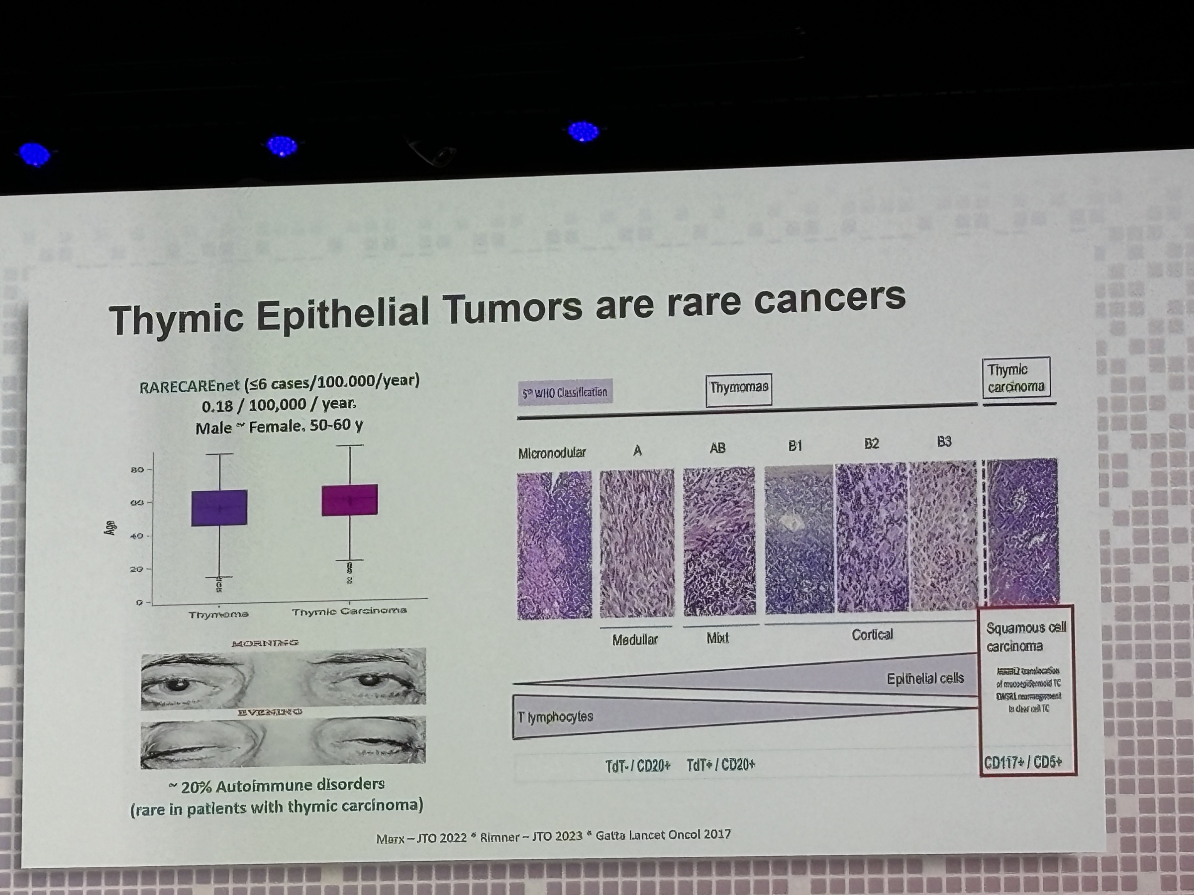 ESMO update on Thymus tumours – Dr S Sundar